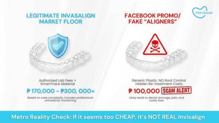 Invisalign Cost Philippines: Avoid Hidden Fees (2026)